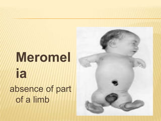 Presentation1.pptx limbs | PPTX