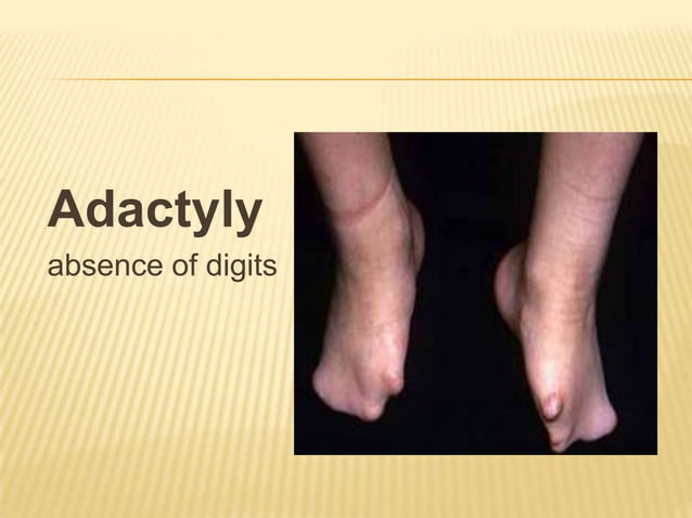 Presentation1.pptx limbs | PPTX