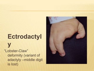 Presentation1.pptx limbs | PPTX