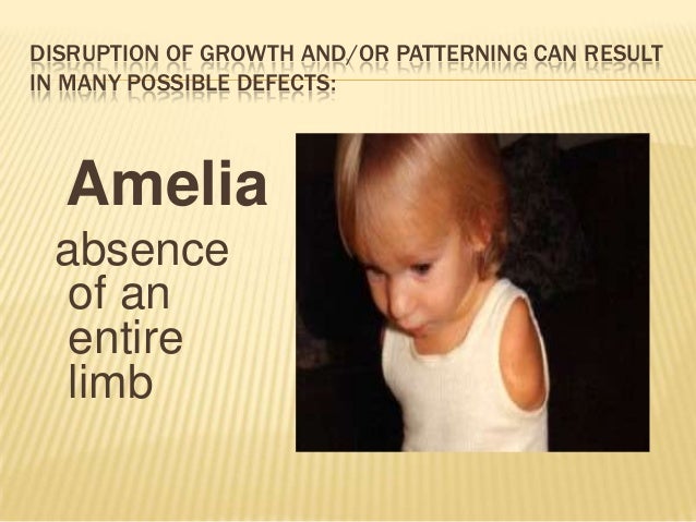 Presentation1.pptx limbs