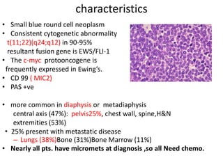 EWINGS SARCOMA & RADIOTHERAPY | PPTX
