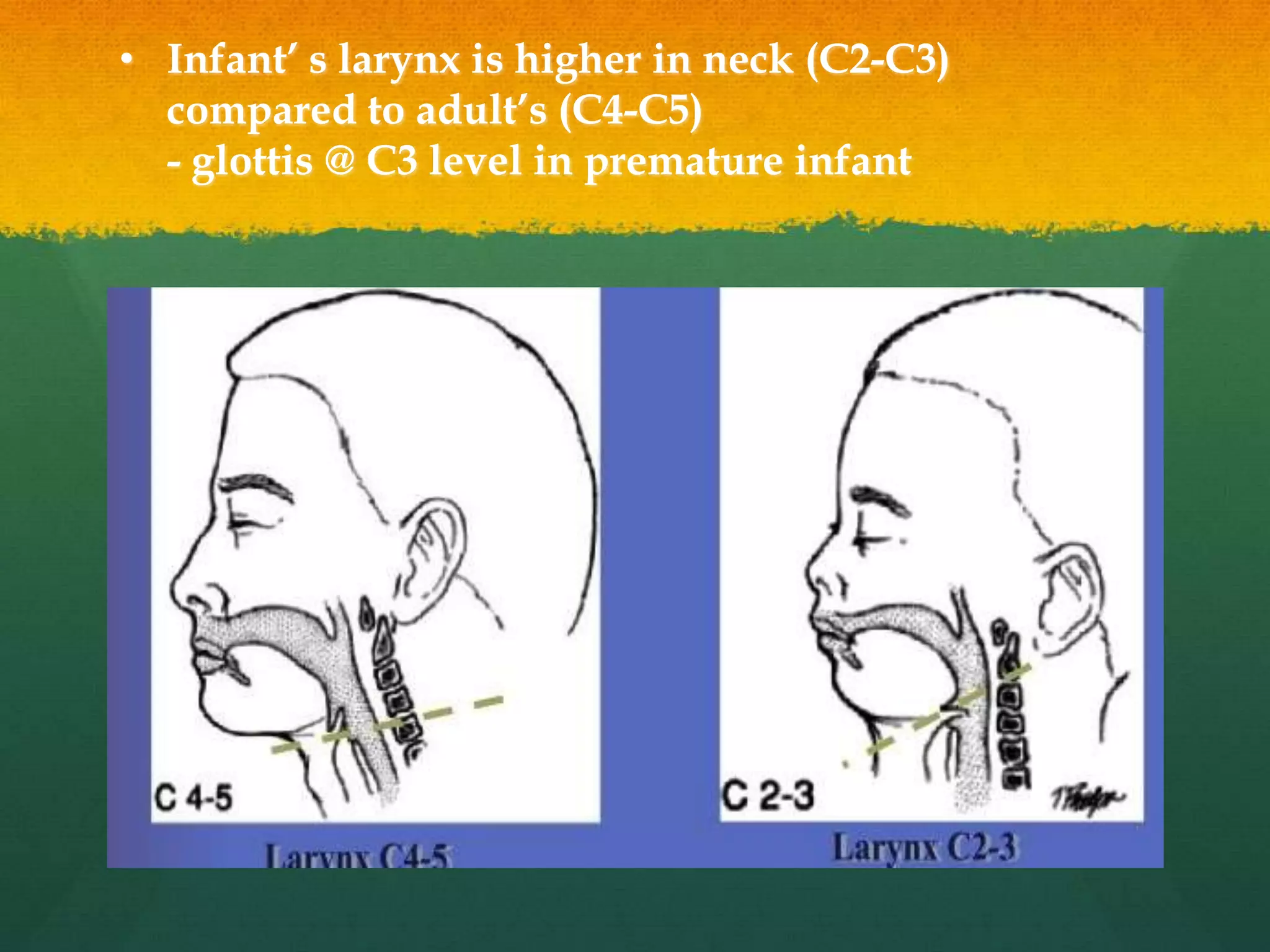 The Premature Infant & Anaesthesia | PPTX