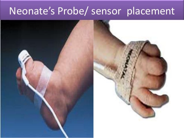 use of pulse oximetry