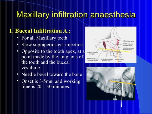Anesthesia