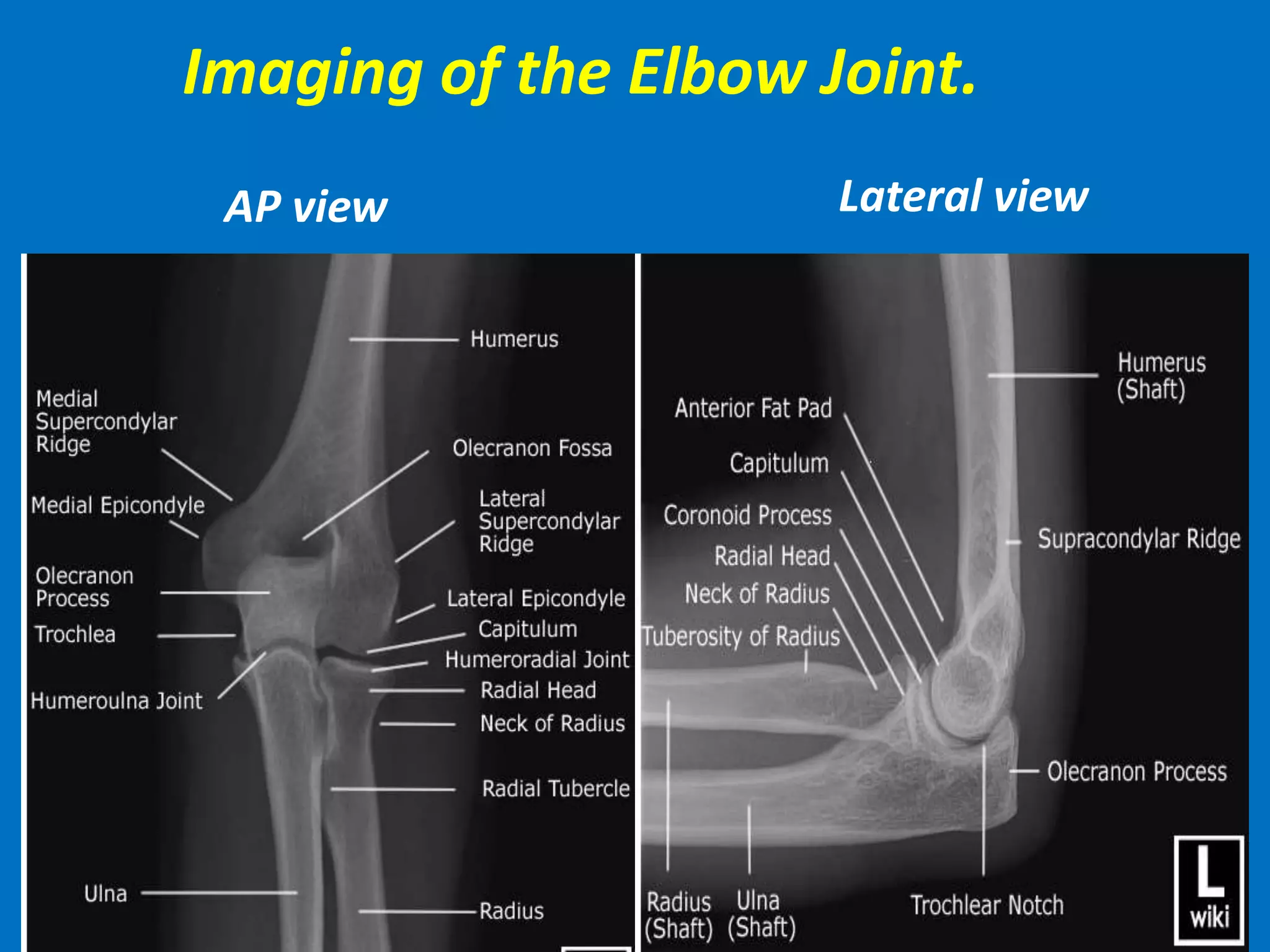 Presentation1.pptx mri of elbow joint | PPTX