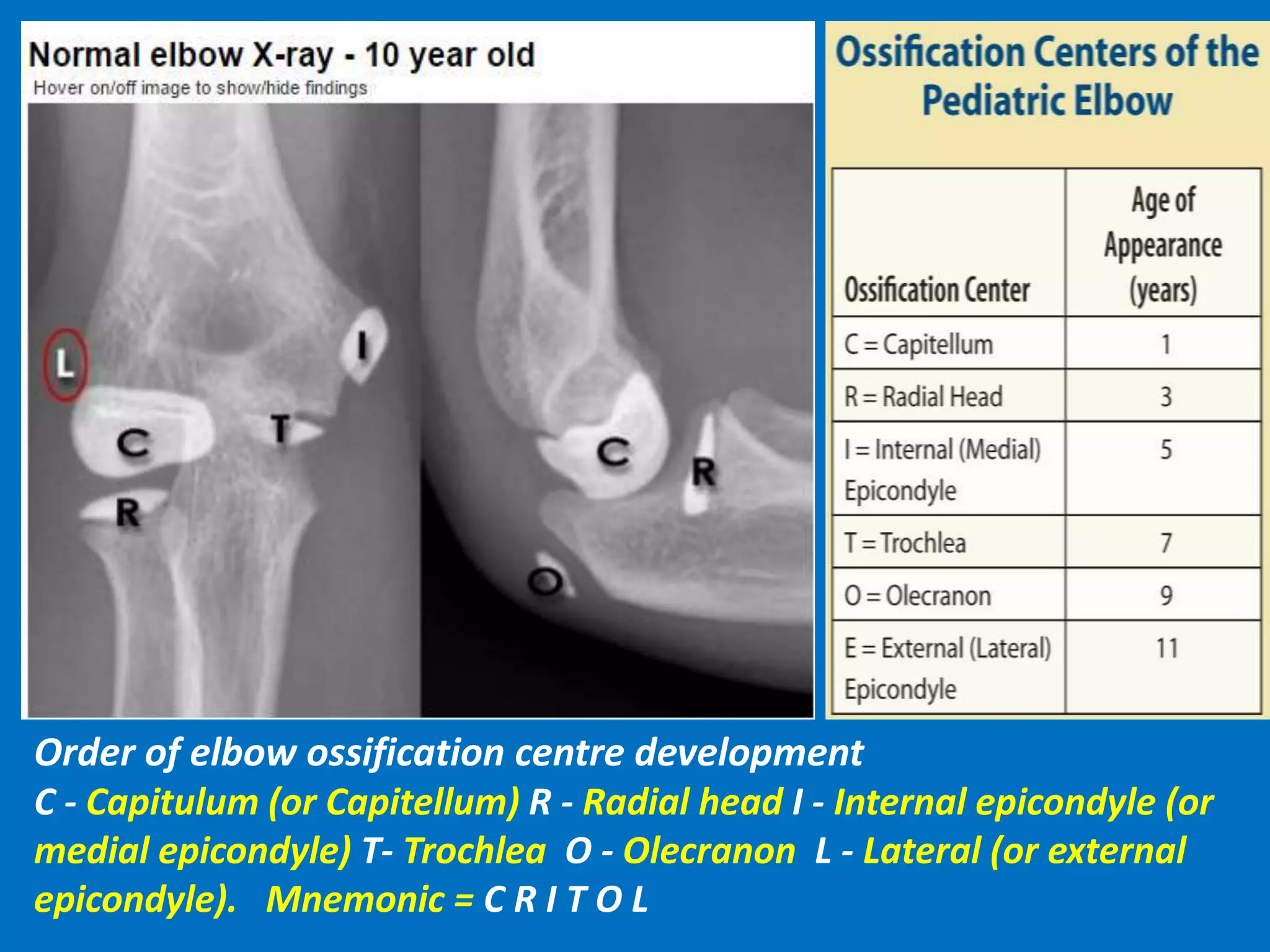 Presentation1.pptx mri of elbow joint | PPTX