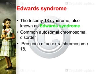 EDWARD SYNDROME | PPTX