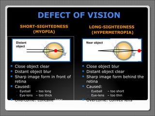 LIGHT AND SIGHT | PPT