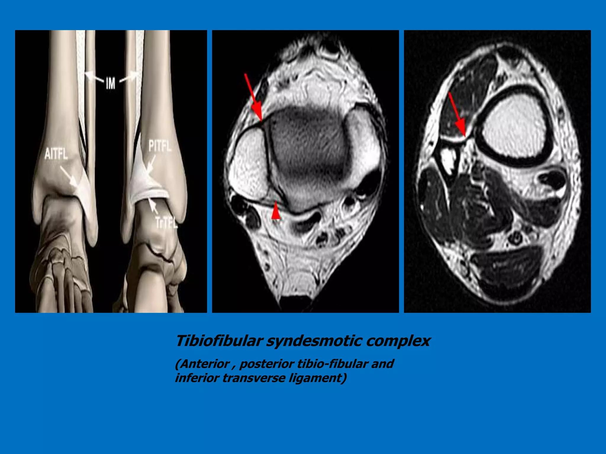 Presentation1.pptx ankle joint.. | PPTX