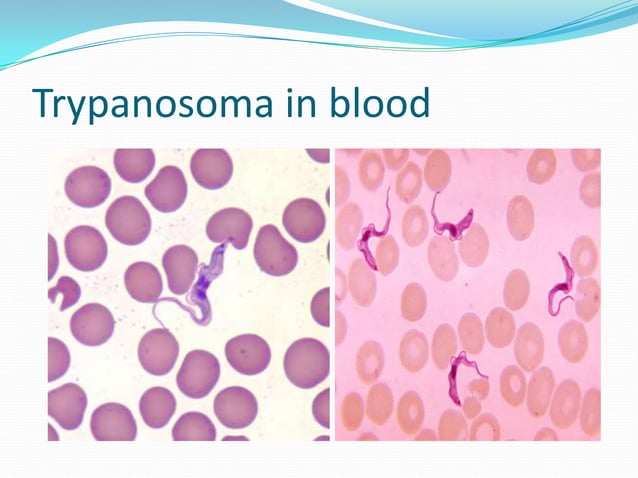 Trypanosoma | PPTX | Infectious Diseases | Diseases and Conditions