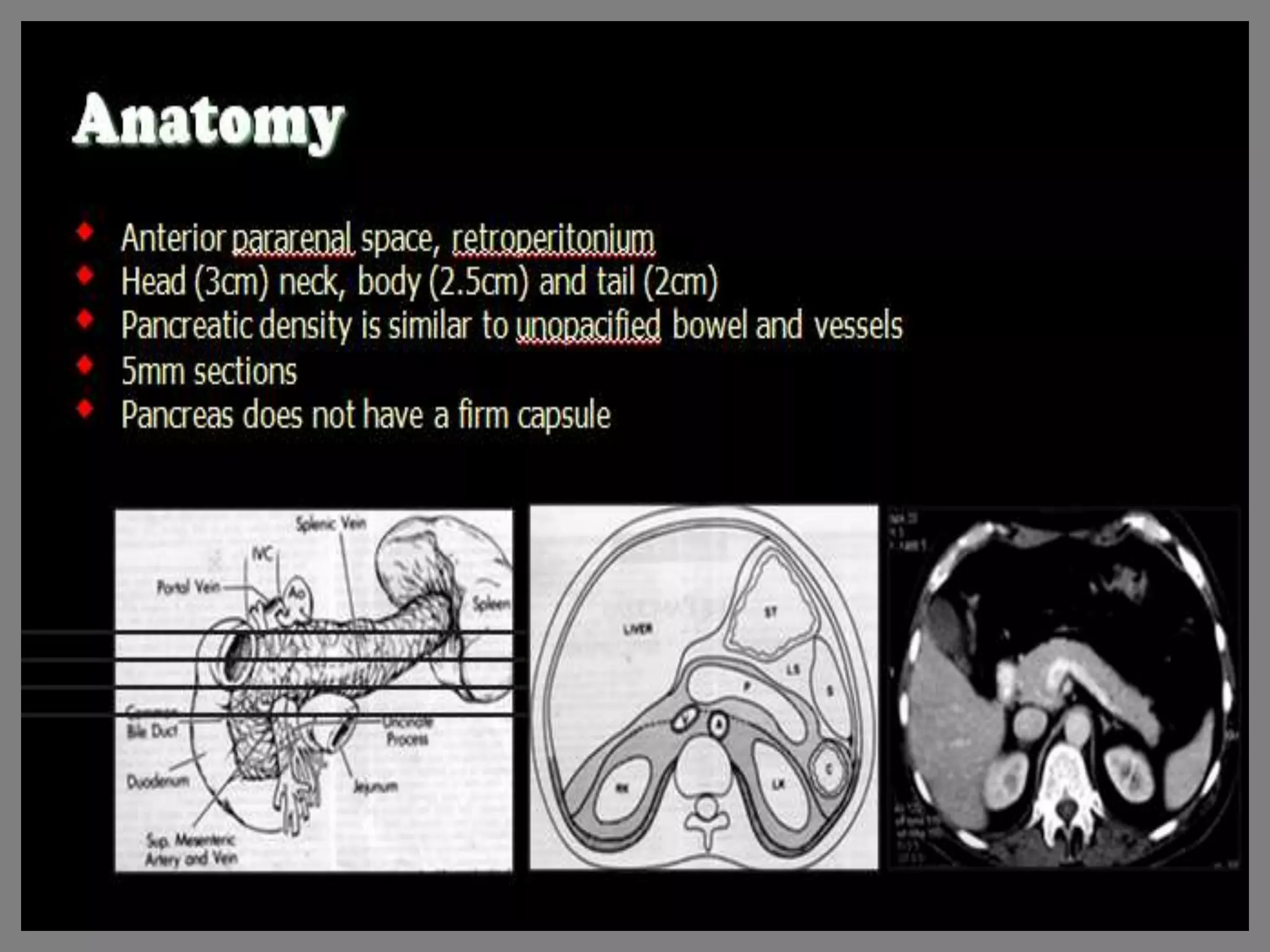 Presentation1.pptx pancreatic disease. | PPT | Free Download