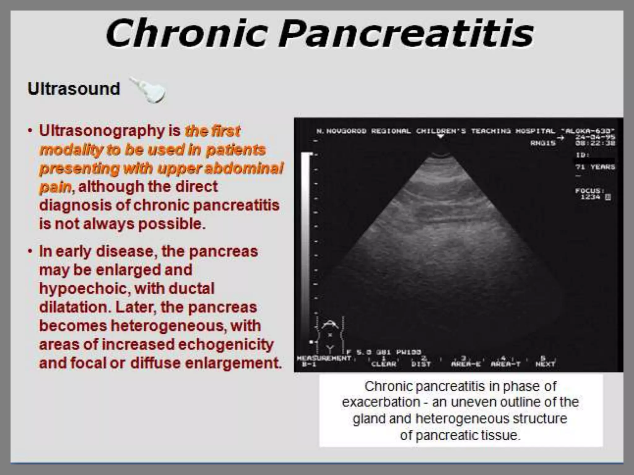 Presentation1.pptx pancreatic disease. | PPT