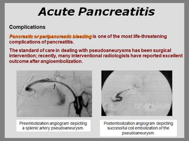 Presentation1.pptx pancreatic disease. | PPT