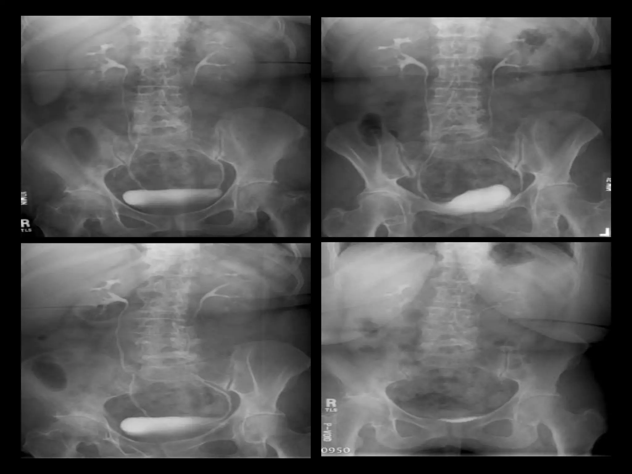 Presentation1.pptx, imaging of the urinary system. | PPTX
