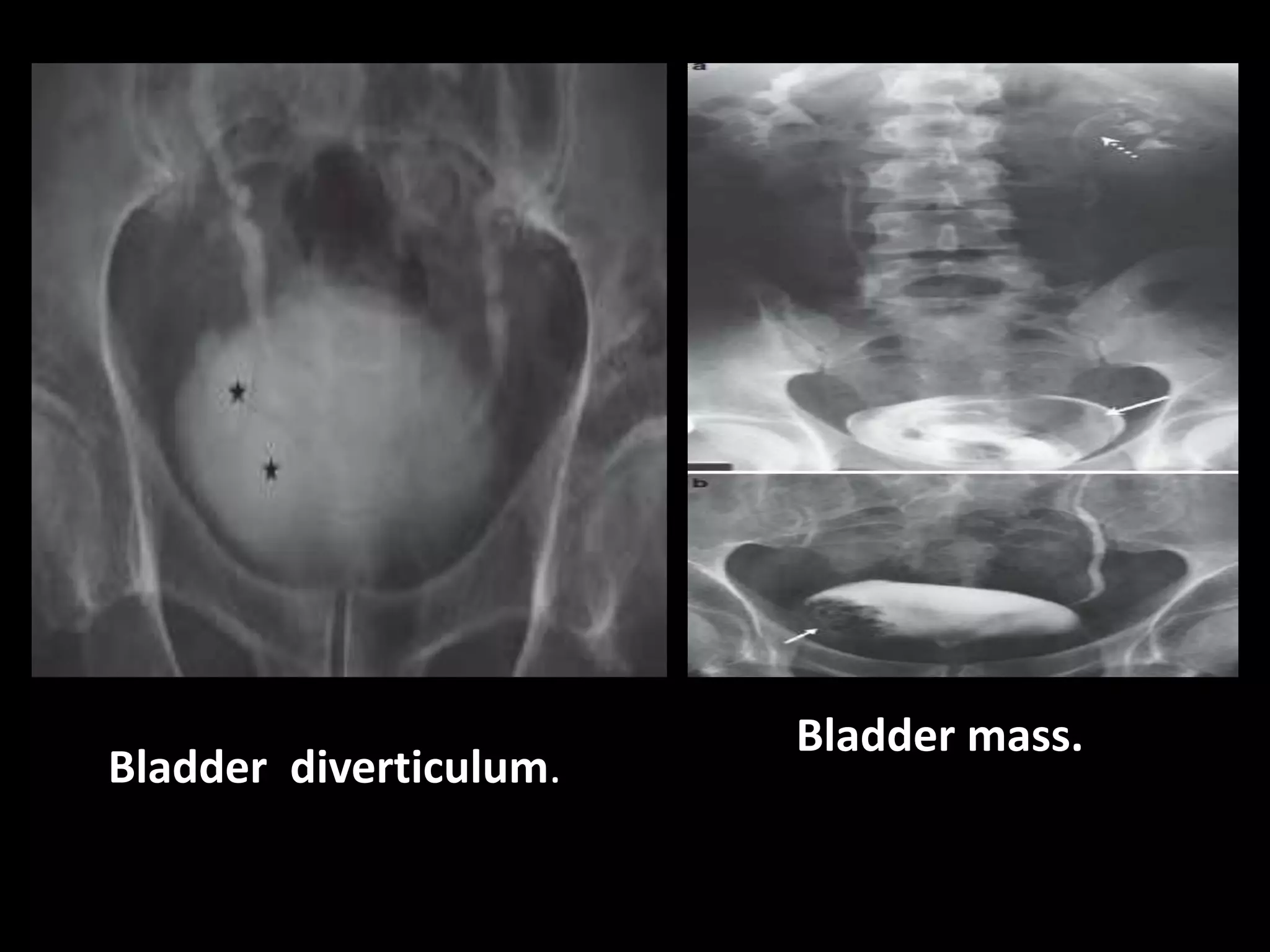 Presentation1.pptx, imaging of the urinary system. | PPTX