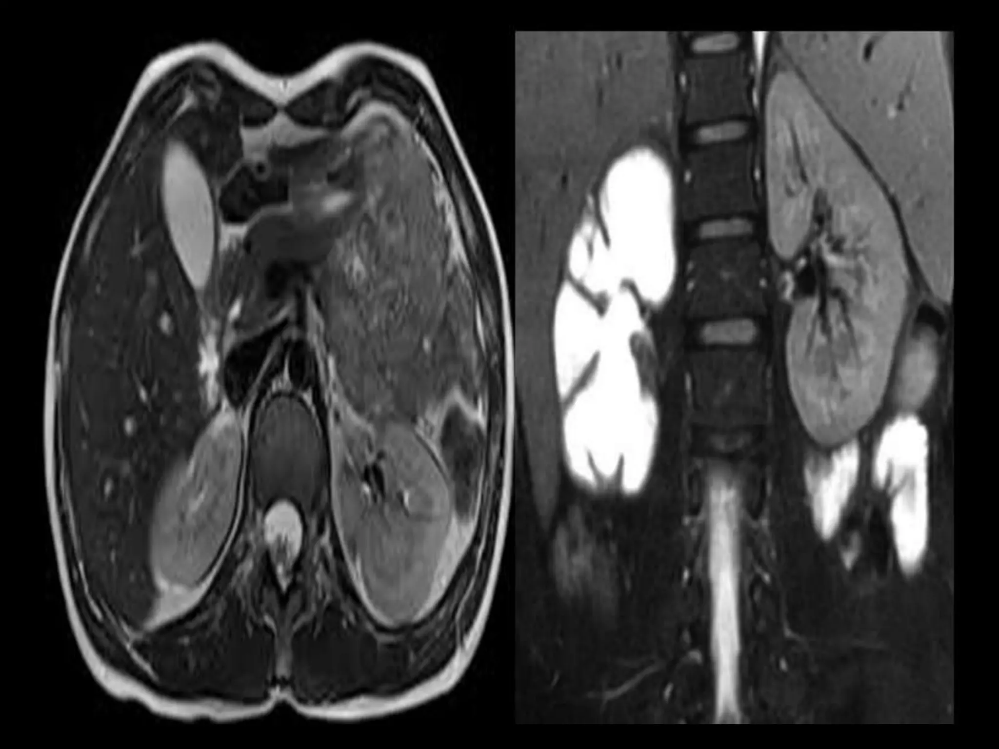 Presentation1.pptx, imaging of the urinary system. | PPTX