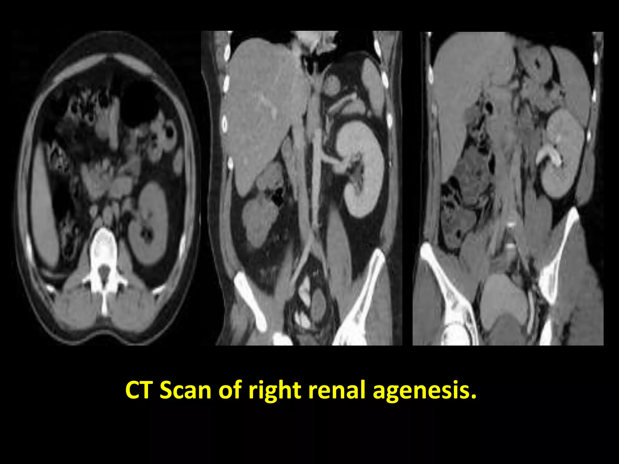 Presentation1.pptx, imaging of the urinary system. | PPTX