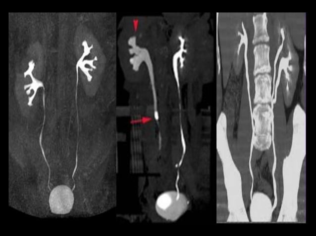 Presentation1.pptx, imaging of the urinary system. | PPTX | Medical ...