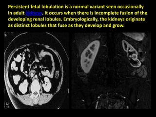 Presentation1.pptx, imaging of the urinary system. | PPTX