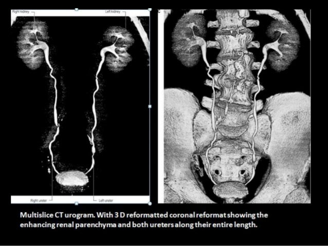 Presentation1.pptx, imaging of the urinary system.