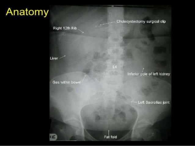 Presentation1.pptx, imaging of the urinary system.