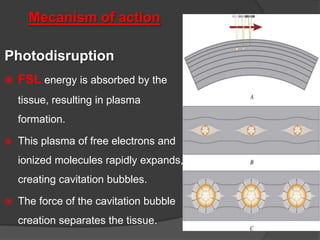 femtosecond laser in ophthalmology by Dr. Hind Safwat (Al Azhr ...