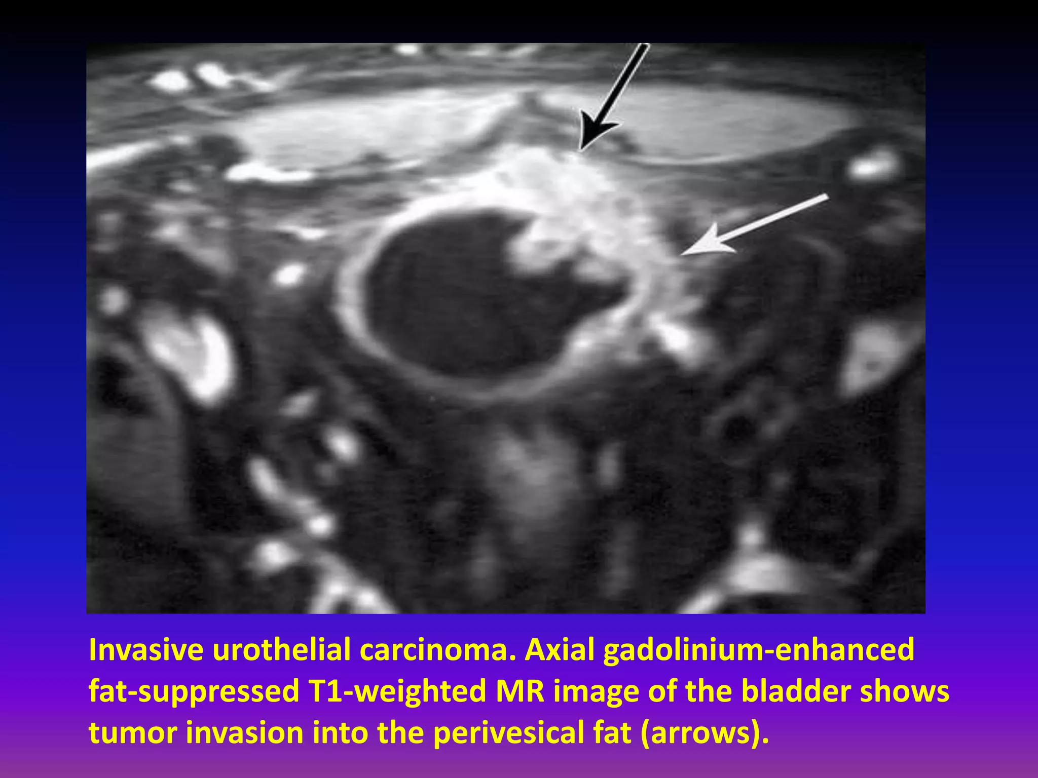 Presentation1.pptx, imaging of the lower urnary system | PPTX