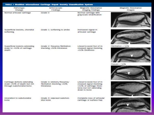 Presentation1.pptx. imaging of the cartilage.