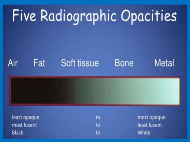 Presentation1.pptx. interpretation of x ray chest. | PPT Presentation1.pptx. interpretation of x ray chest. | PPT