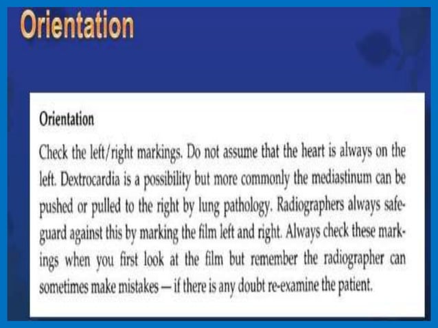 Presentation1.pptx. interpretation of x ray chest. | PPT Presentation1.pptx. interpretation of x ray chest. | PPT