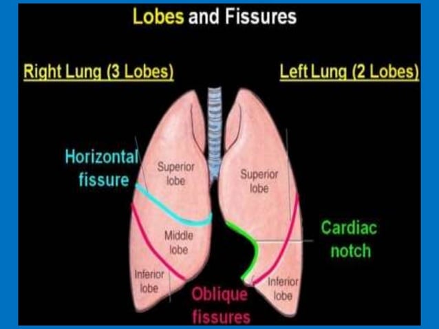 Presentation1.pptx. interpretation of x ray chest. | PPT Presentation1.pptx. interpretation of x ray chest. | PPT