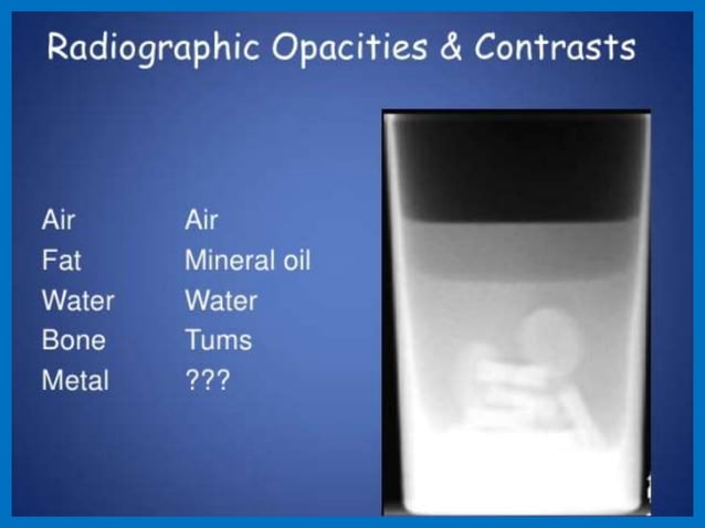 Presentation1.pptx. interpretation of x ray chest. Presentation1.pptx. interpretation of x ray chest.