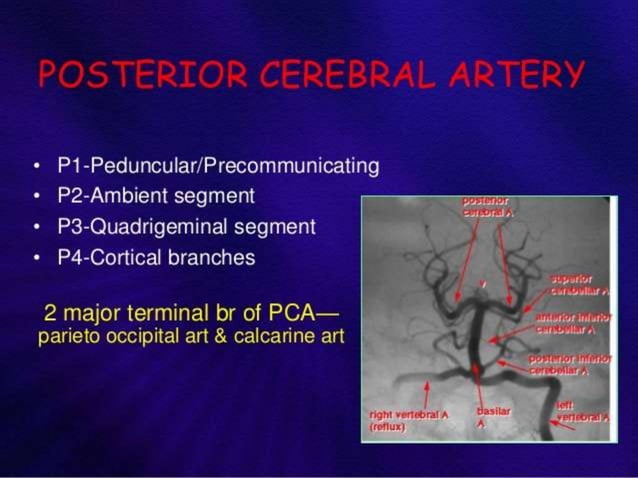 Presentation1.pptx, intra cranial vascular malformation. | PPTX