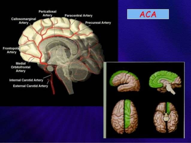 Presentation1.pptx, intra cranial vascular malformation. | PPTX