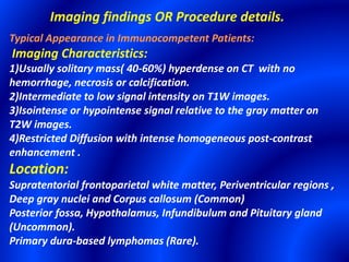 Presentation1.pptx, imaging modalities of intra cerebral lymphoma. | PPT
