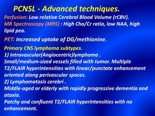 Presentation1.pptx, imaging modalities of intra cerebral lymphoma. | PPT