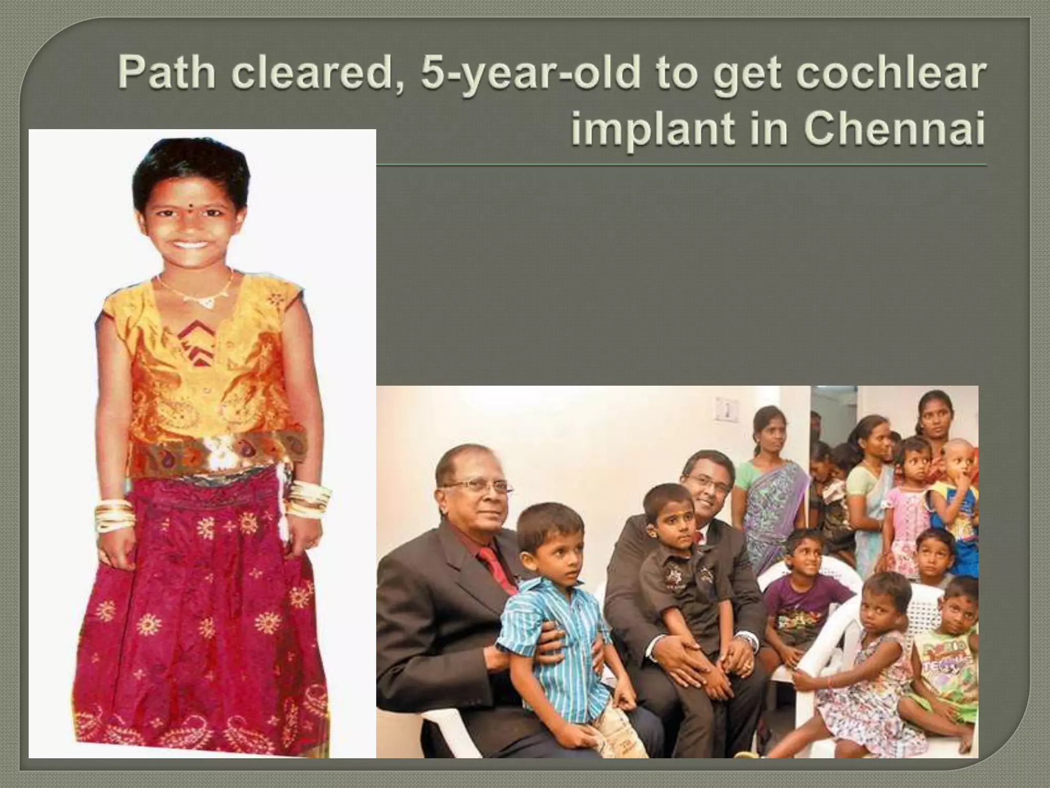 cochlear implant | PPTX
