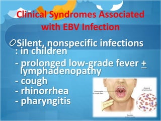 Epstein-Barr Virus | PPTX
