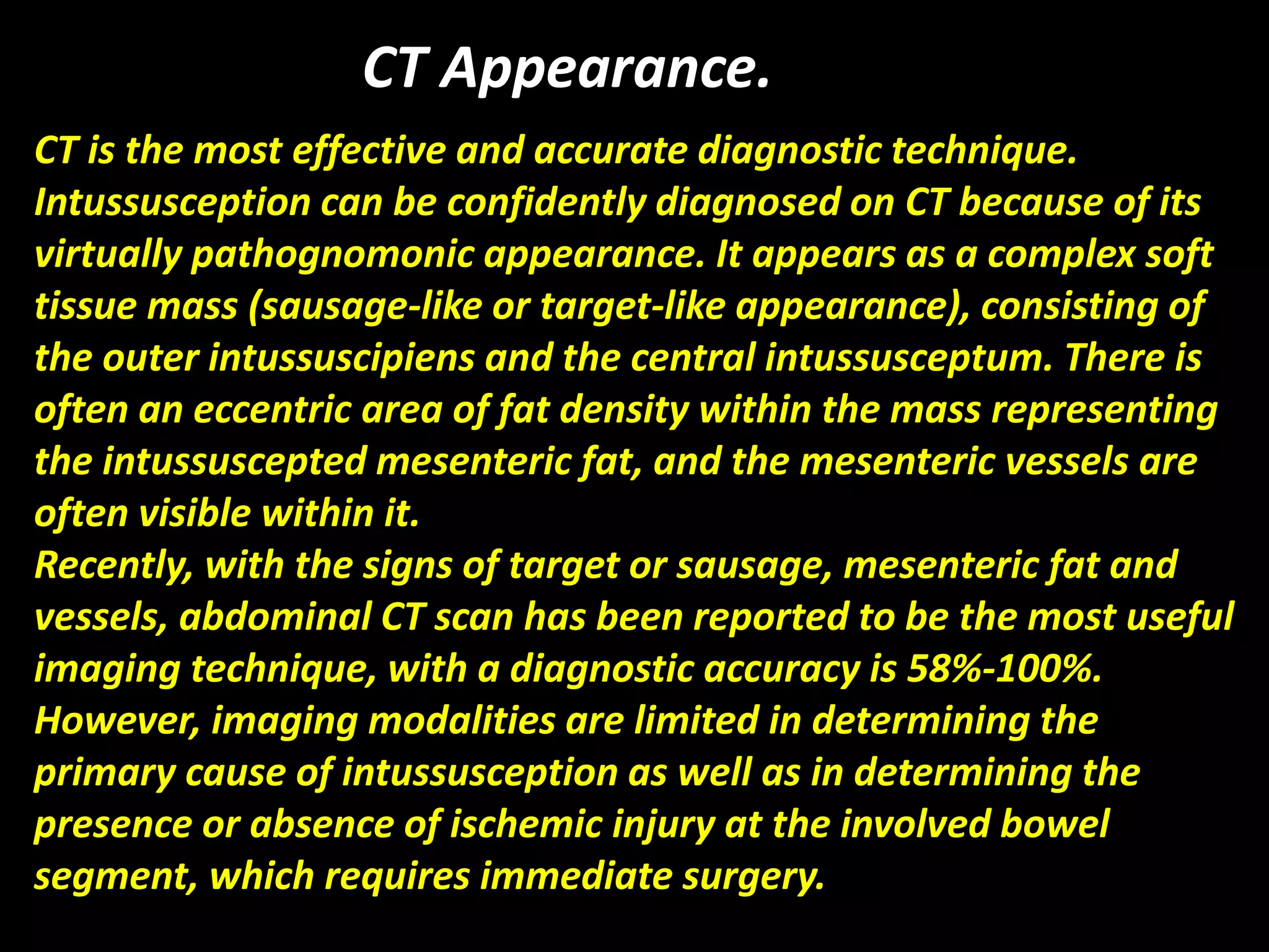 Presentation1.pptx, radiological imaging of intusussception. | PPTX