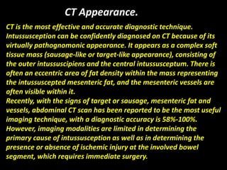 Presentation1.pptx, radiological imaging of intusussception. | PPTX