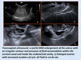 The Fluid In Cervical Canal
