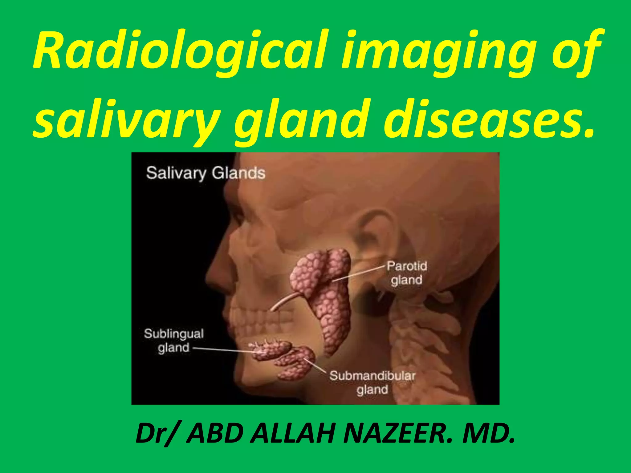 Presentation1.pptx, radiological imaging of salivary glands diseases. | PPTX | Ear, Nose and ...