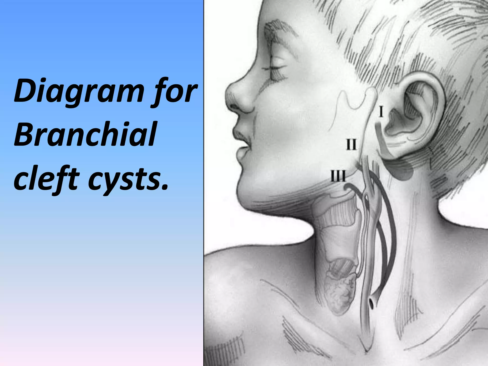 Presentation1.pptx, radiological imaging of pediatric neck masses. | PPTX