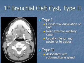 Branchial Cleft Cyst Ultrasound