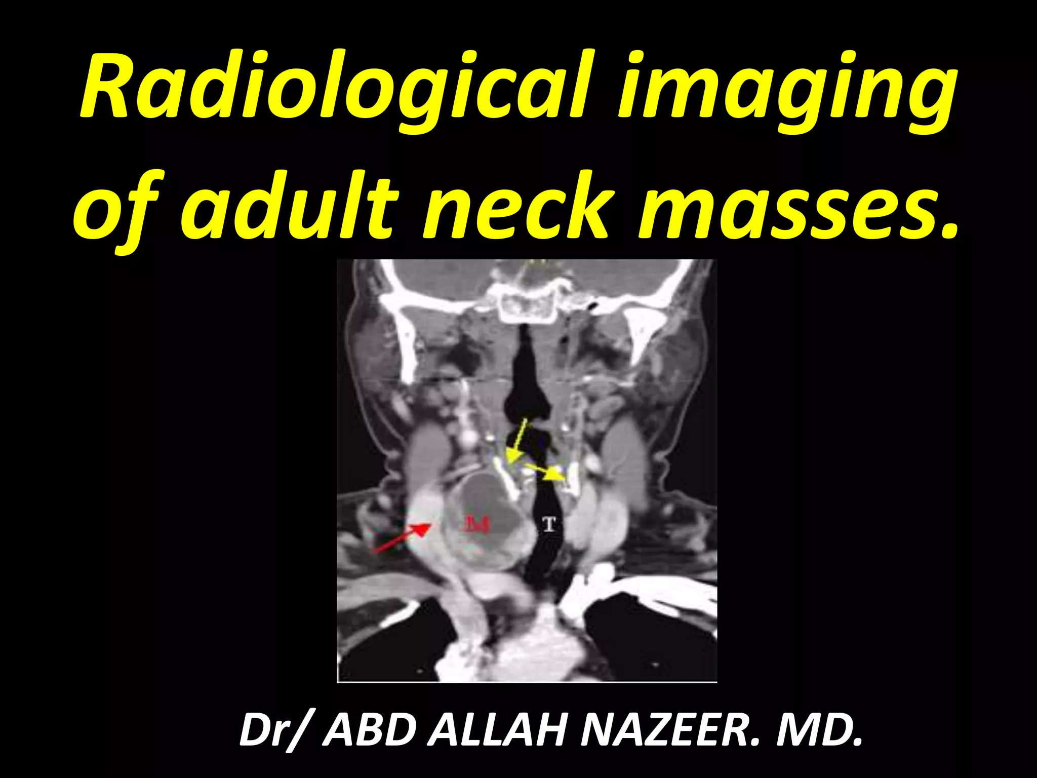 Presentation1.pptx, radiological imaging of adult neck masses. | PPTX