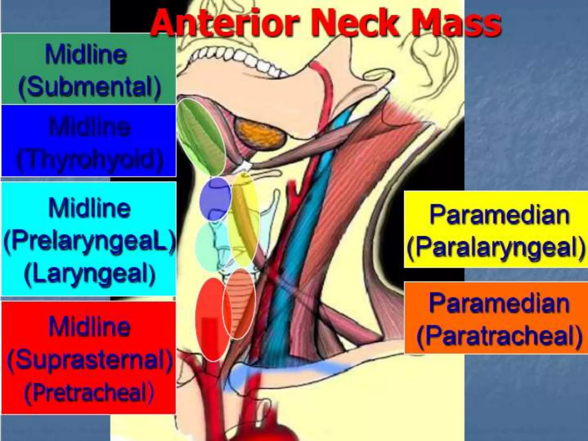 Presentation1.pptx, radiological imaging of adult neck masses. | PPTX