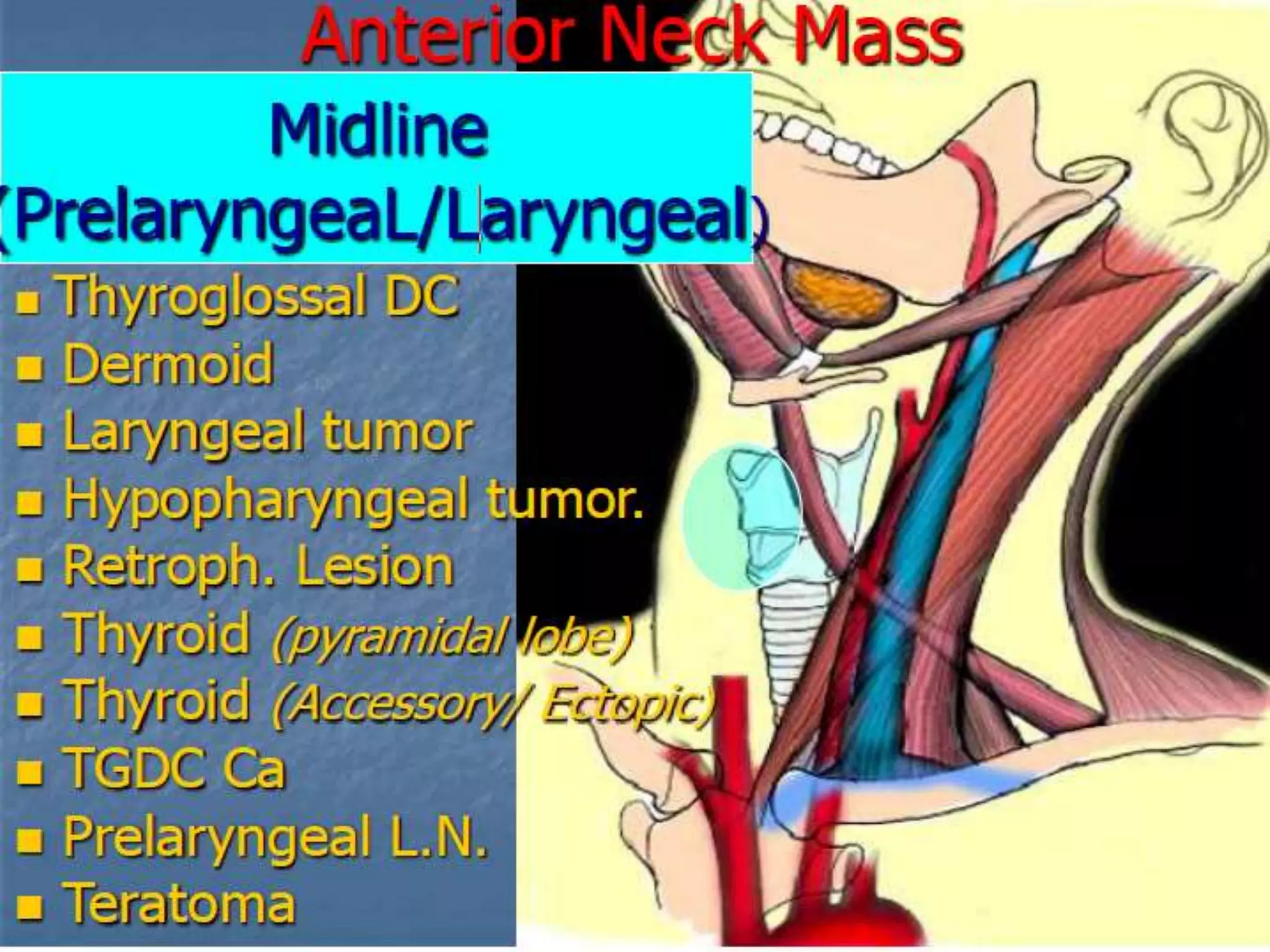 Presentation1.pptx, radiological imaging of adult neck masses. | PPTX