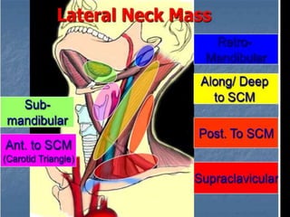 Presentation1.pptx, radiological imaging of adult neck masses. | PPTX