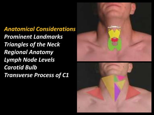 Presentation1.pptx, radiological imaging of adult neck masses. | PPTX ...