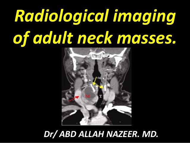 Presentation1.pptx, radiological imaging of adult neck masses.